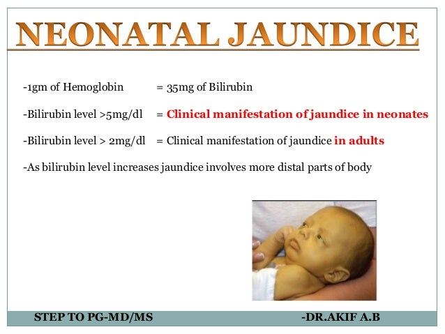 Neonatal jaundice