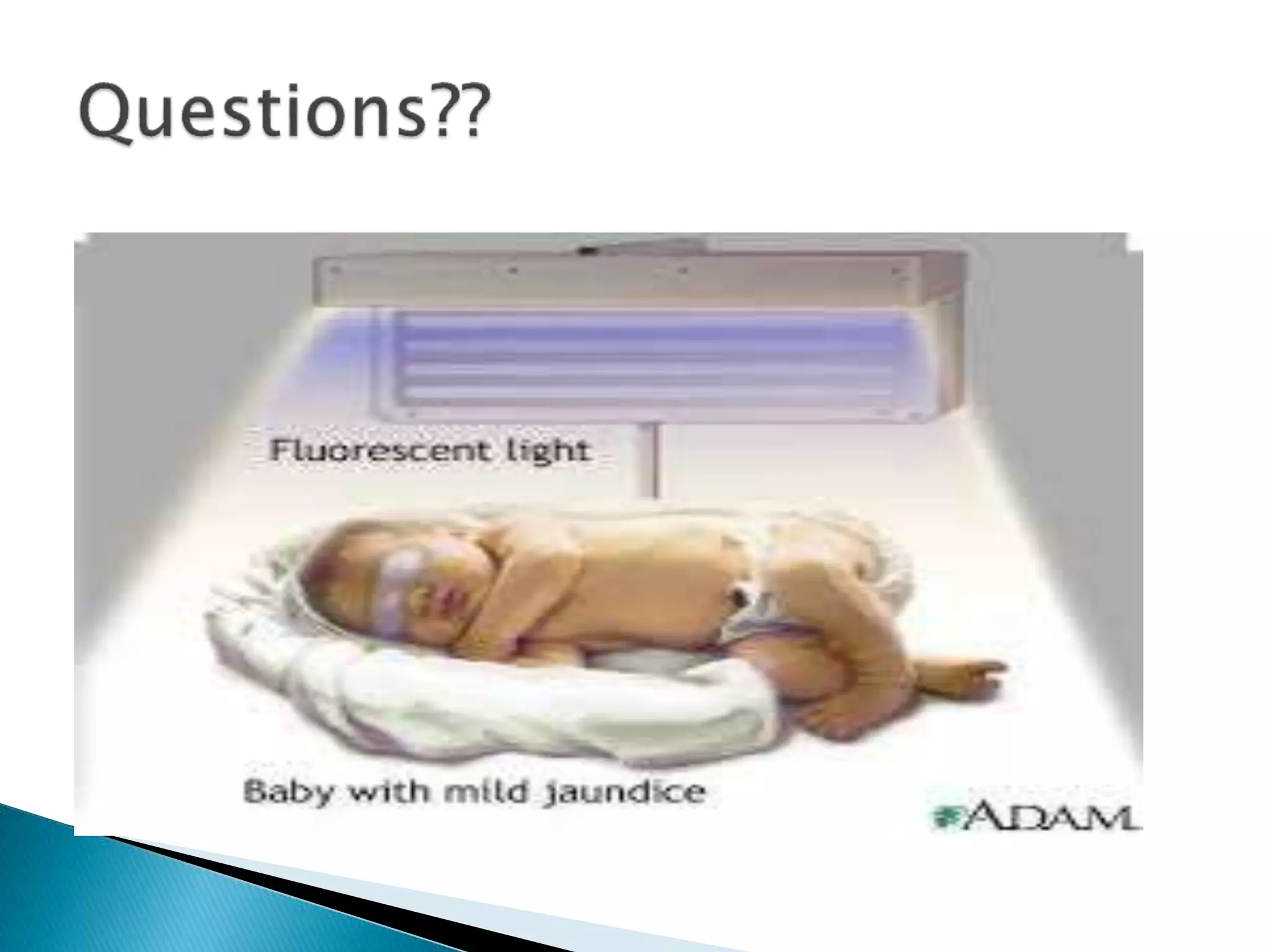 Neonatal jaundice | PPTX