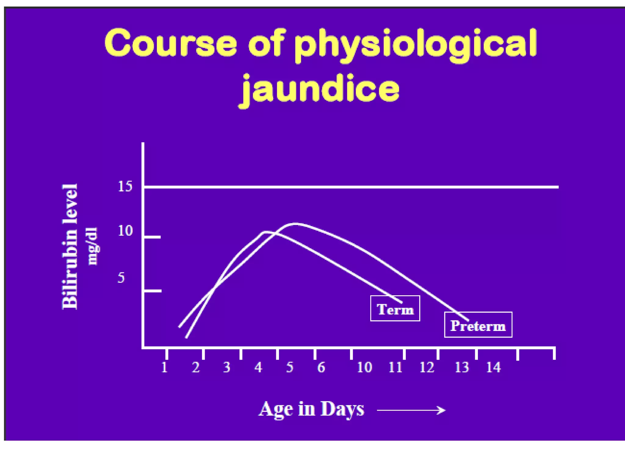 Neonatal jaundice | PPTX