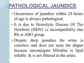 Physiological jaundice among newborns/ Icterus neonatorum | PPTX ...