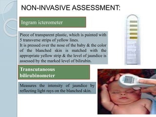 Physiological jaundice among newborns/ Icterus neonatorum | PPTX ...