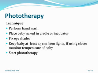 Neonatal jaundice, cause, Etiology, Treatment, nursing Care of baby in ...
