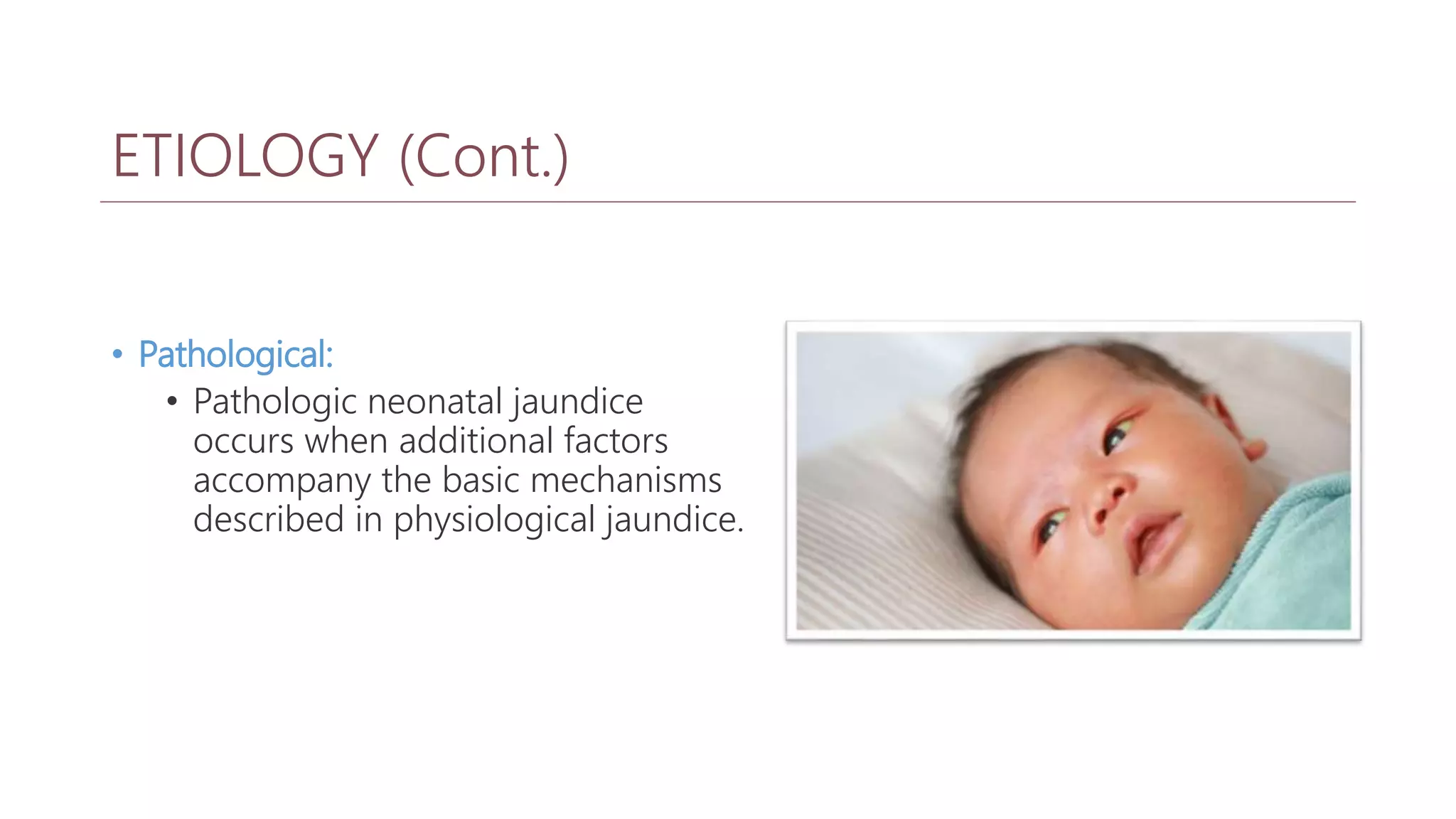 Approach to Neonatal jaundice | PPTX