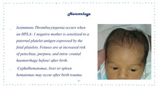 Neonatal Jaundice | PPT