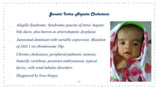 Neonatal Jaundice | PPT