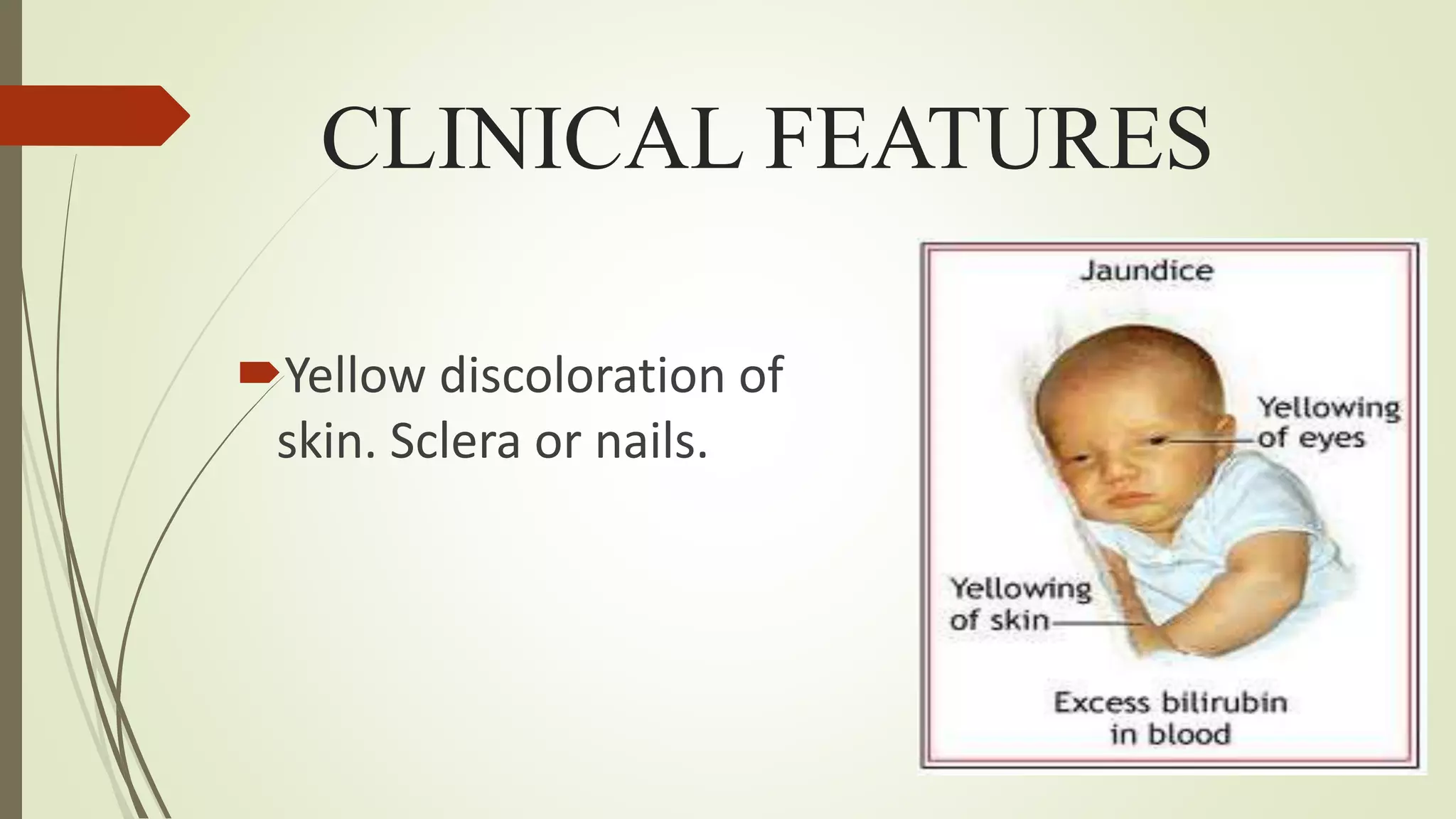 Neonatal jaundice | PPTX