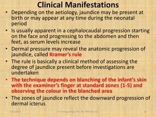Neonatal Jaundice.pdf