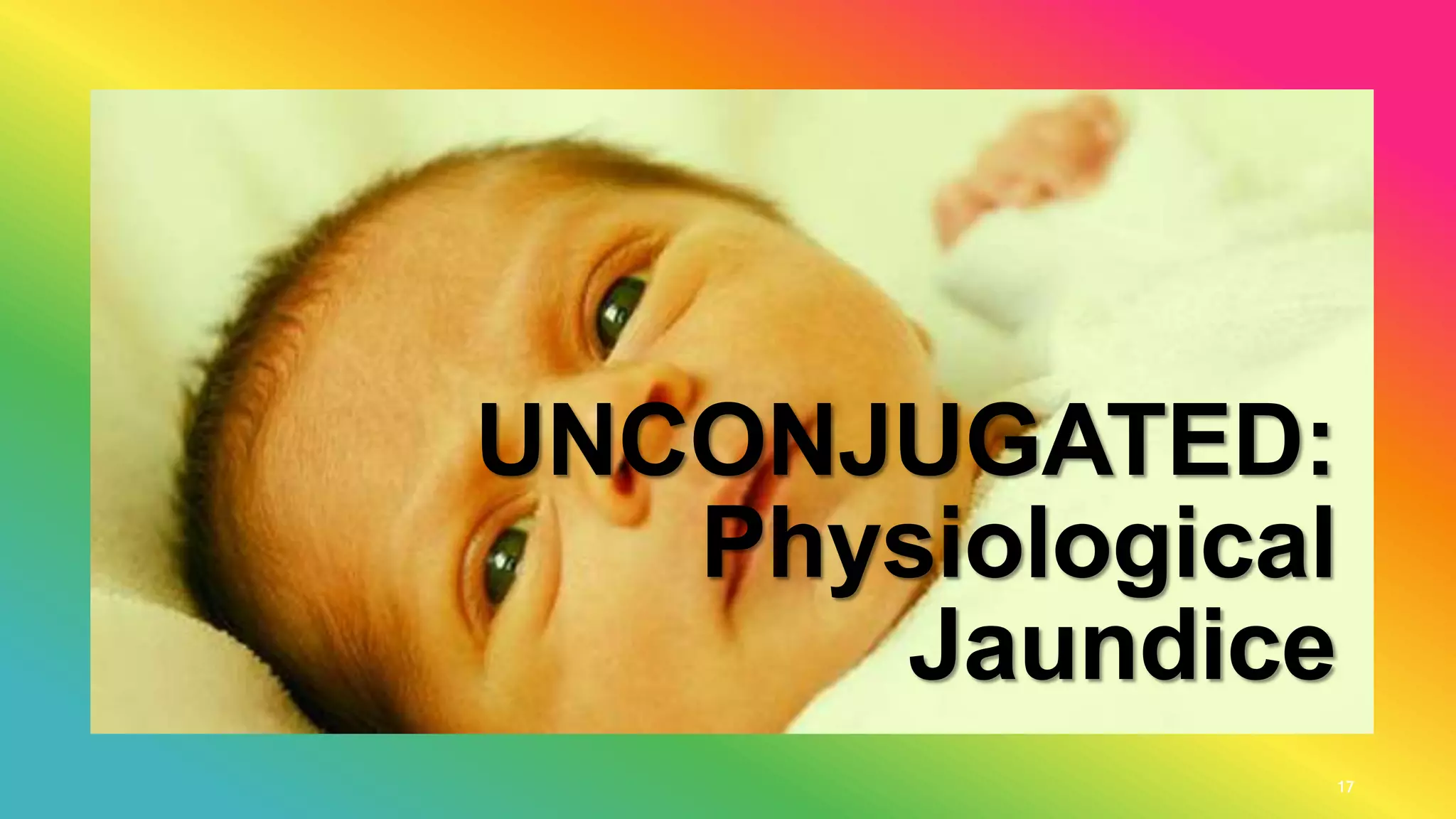 NEONATAL JAUNDICE.pptx