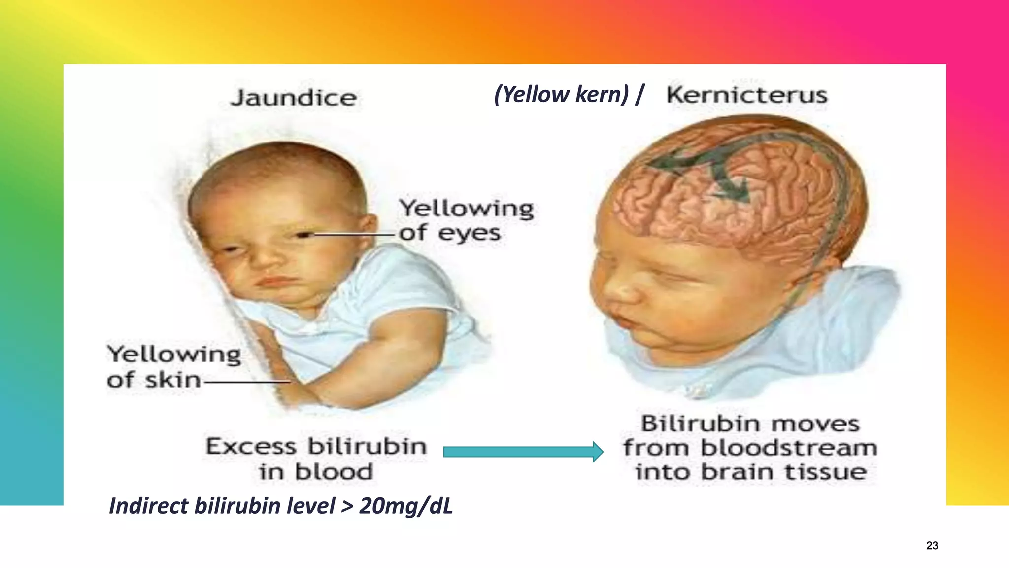 NEONATAL JAUNDICE.pptx