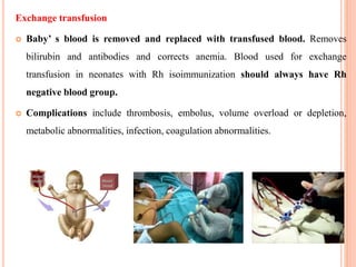 Neonatal Jaundice.pptx