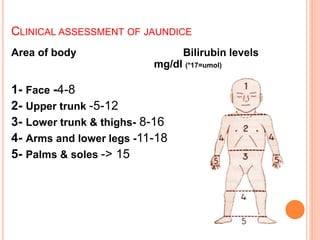 Neonatal Jaundice.pptx
