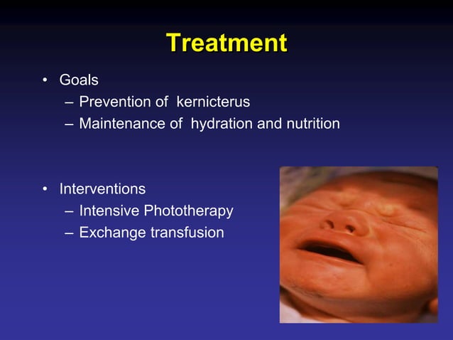 NEONATAL JAUNDICE.power point presentation | PPT