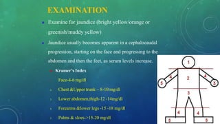 Neonatal jaundice hyperbilirubinemia | PPTX