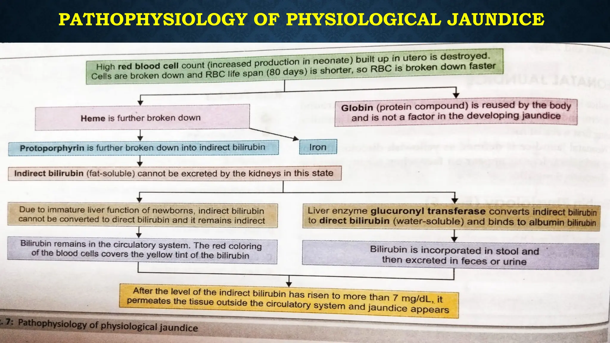 Neonatal Jaundice Pathophysiology Flow Chart