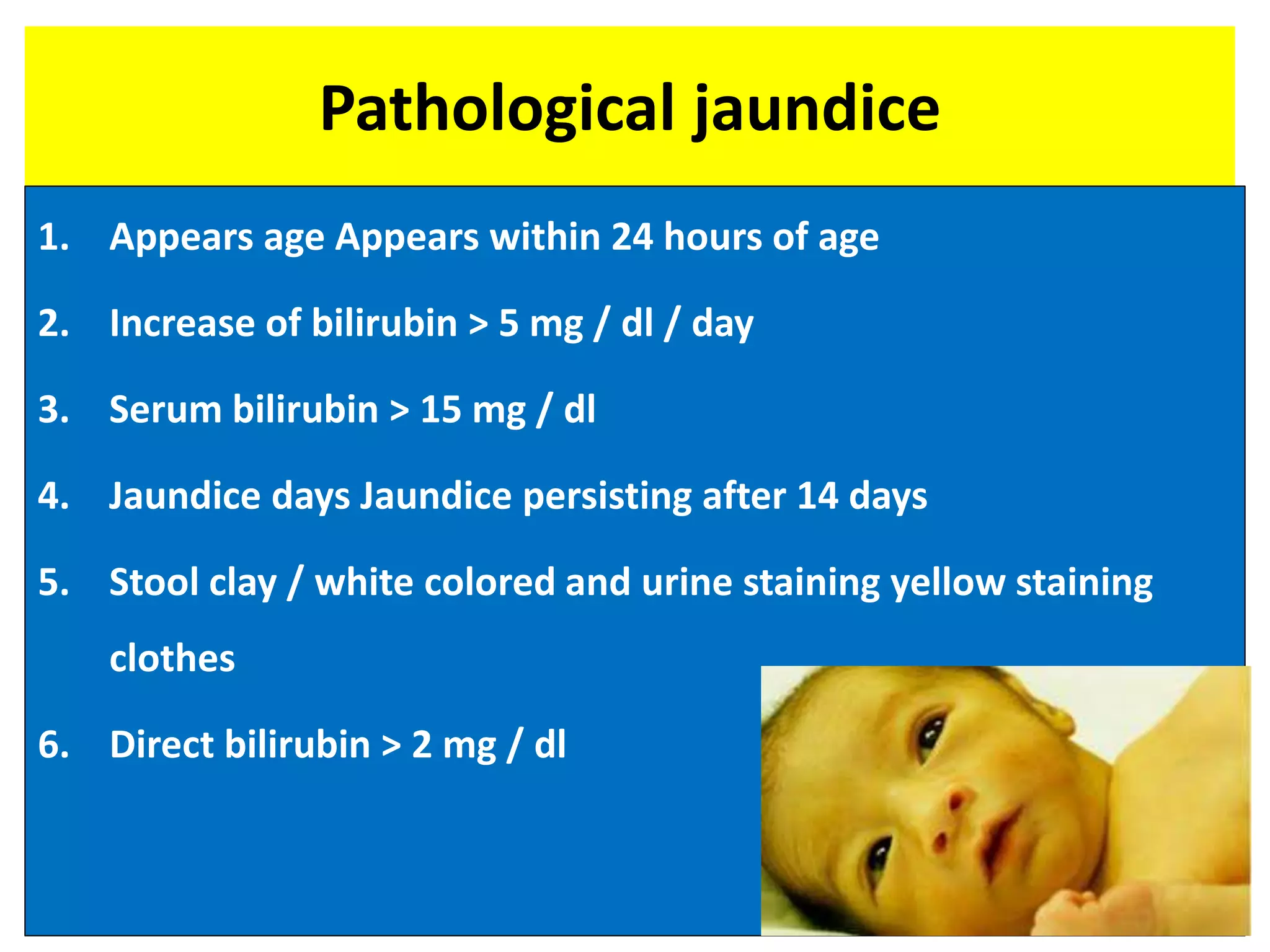 Neonatal jaundice - 2017 | PPTX