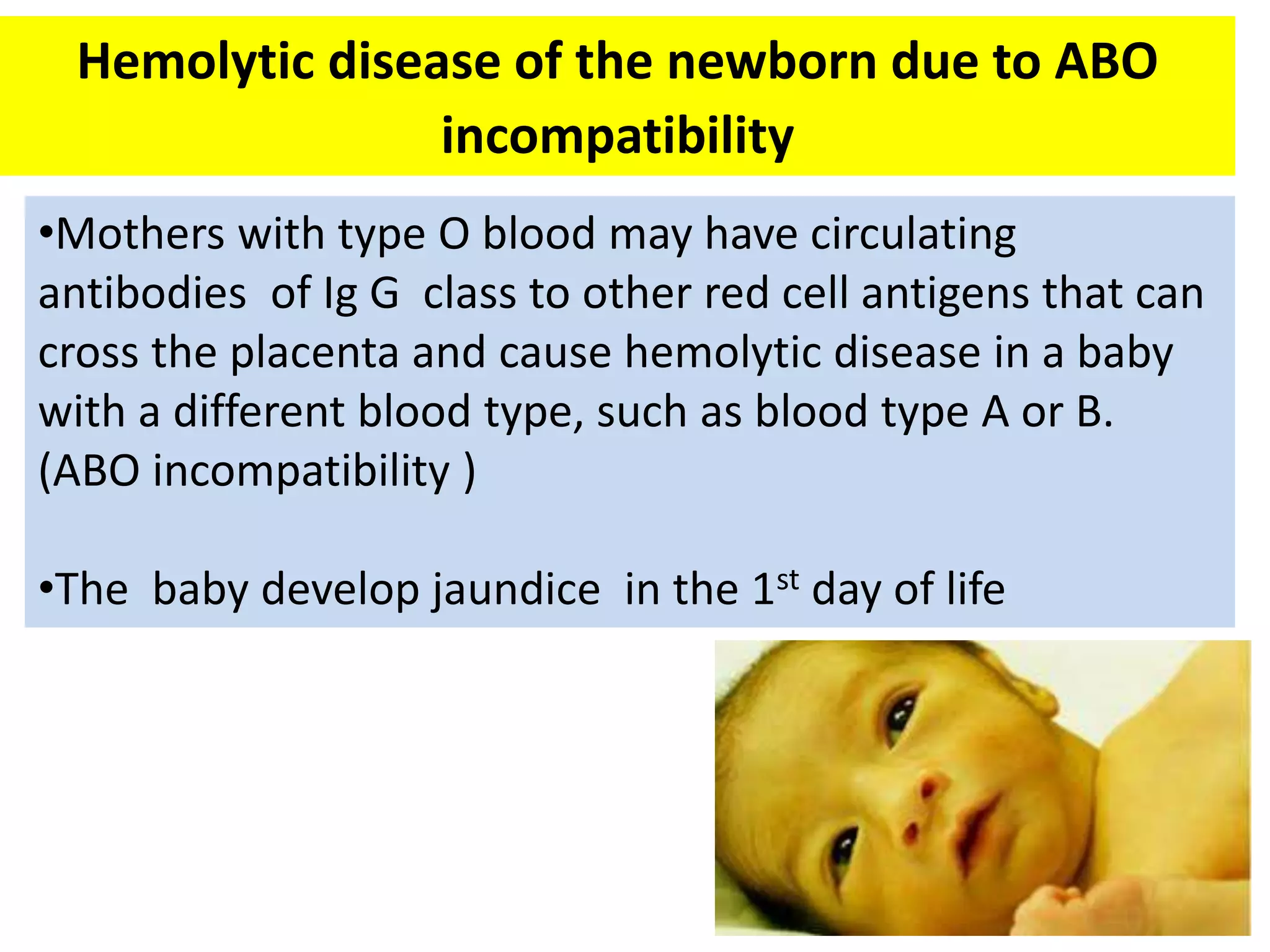 Neonatal jaundice - 2017 | PPTX