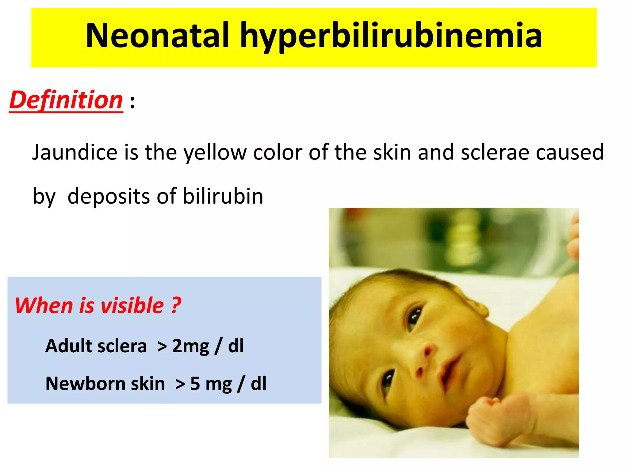 Neonatal jaundice - 2017 | PPTX