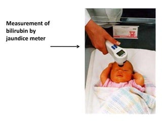 Neonatal jaundice - 2017 | PPTX