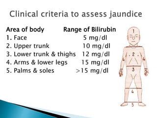 Neonatal jaundice | PPTX