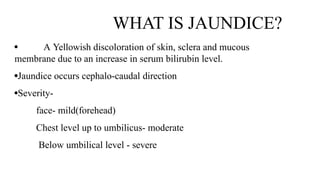 Neonatal Jaundice presentation for paediatric doctors pptx | PPTX