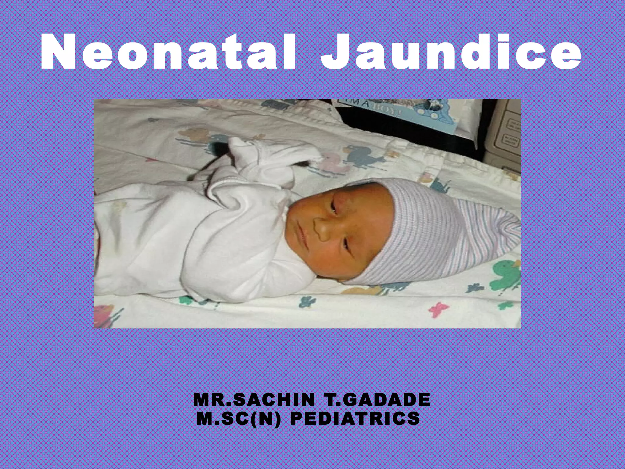 Neonatal Jaundice Pptx Muhadharaty Neonatal Jaundice | PDF