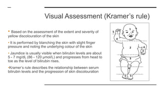 Neonatal Jaundice (2).pdf--------------- | PDF