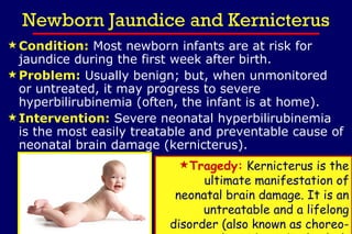 Neonatal Jaundice,Bhutan | PPT
