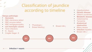Neonatal jaundice by Raghad FM R2 Latest AAP Guideline 2022 | PPTX