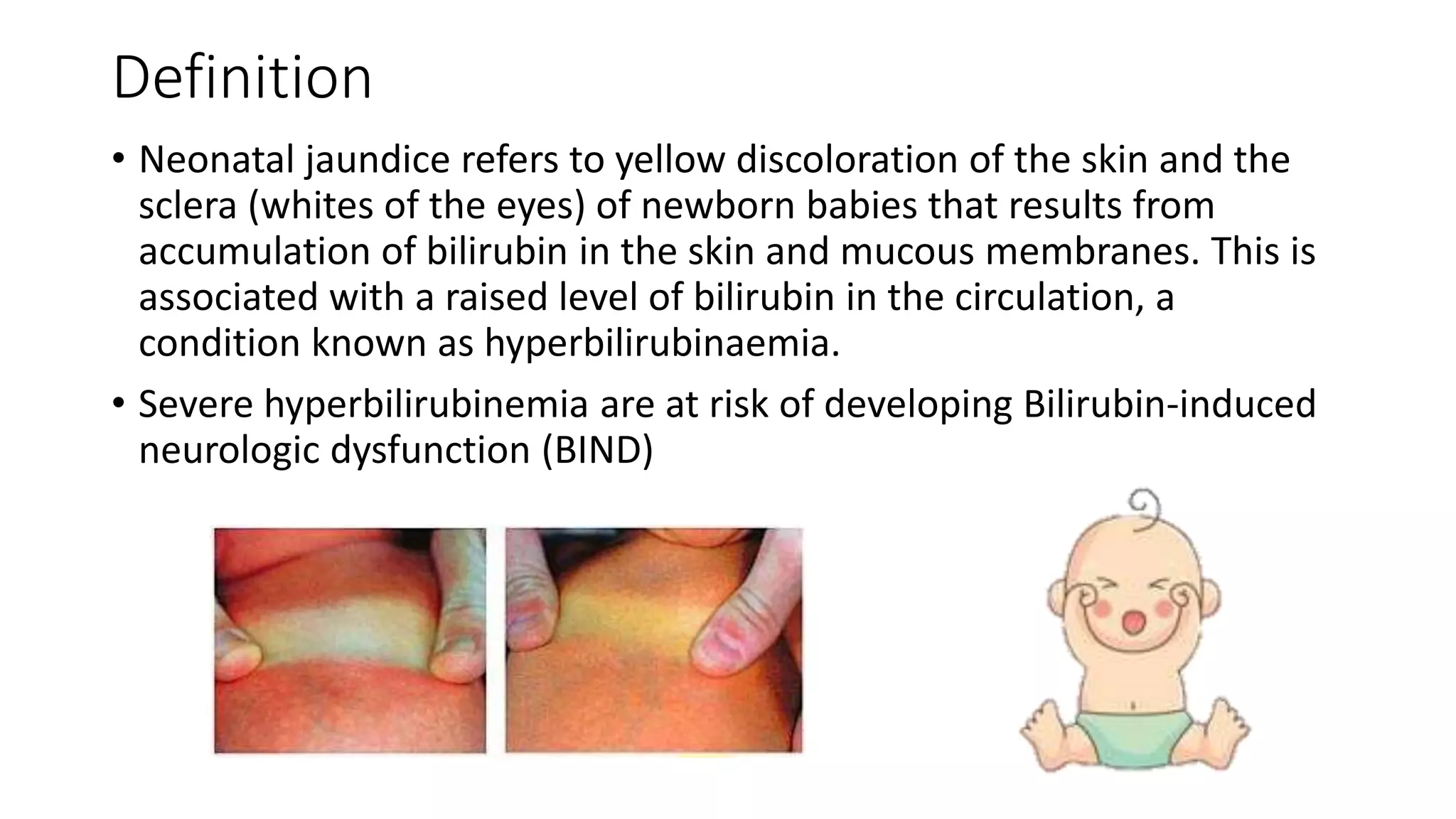 Neonatal jaundice Overview and management | PPT
