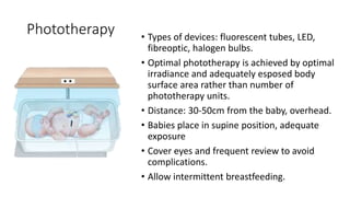 Neonatal jaundice Overview and management | PPTX