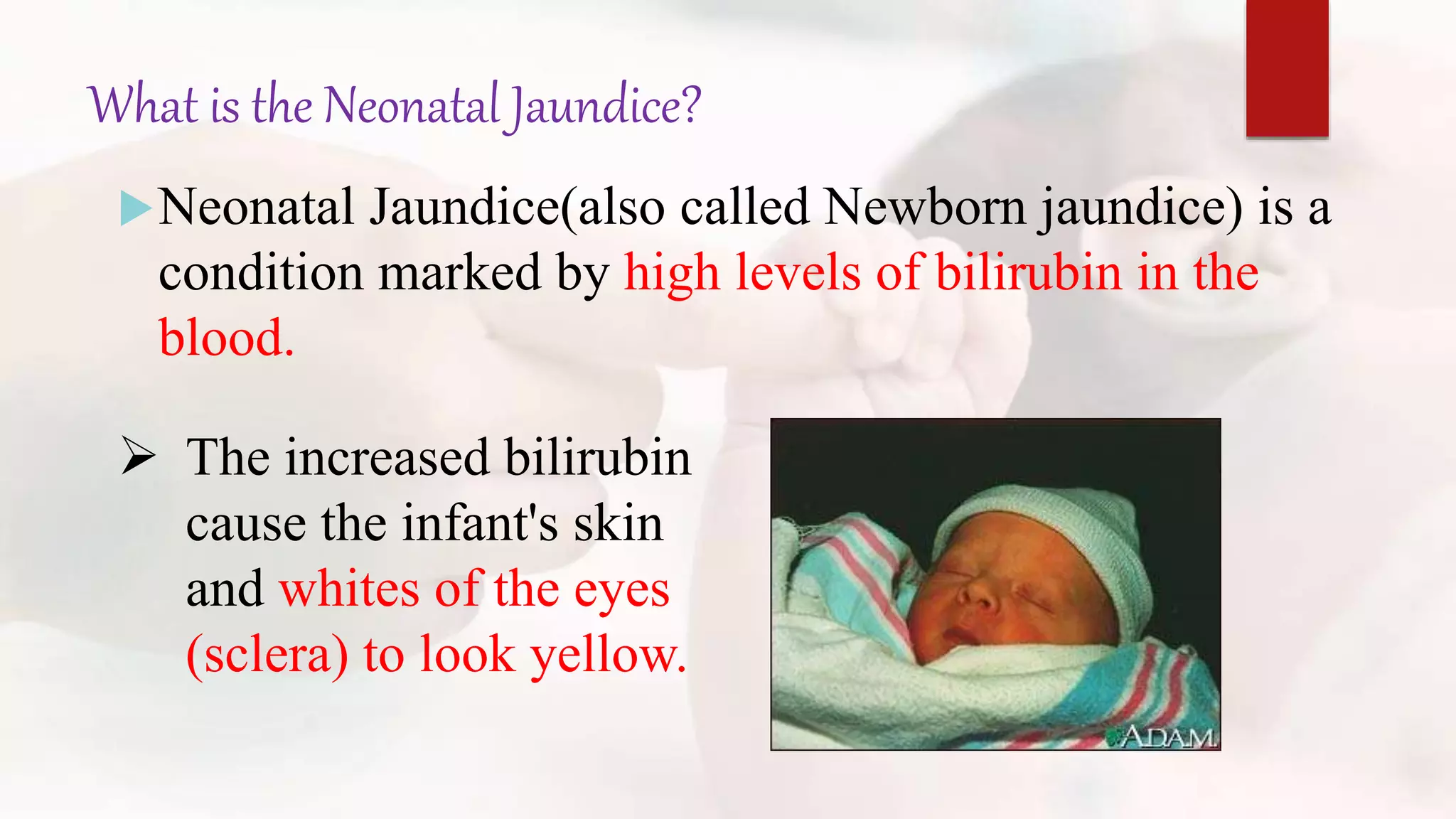 NEONATAL JAUNDICE .pptx