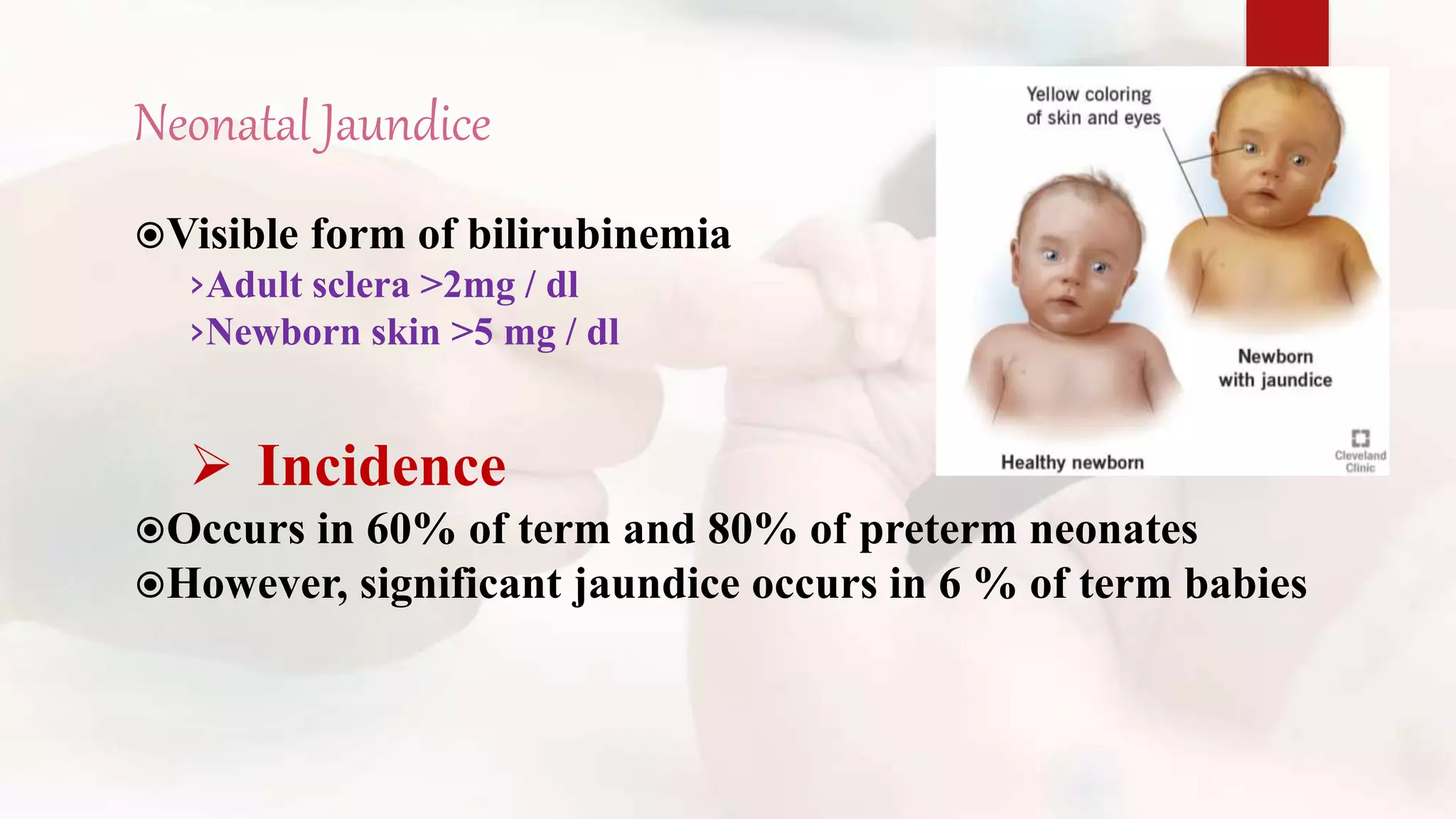 NEONATAL JAUNDICE .pptx