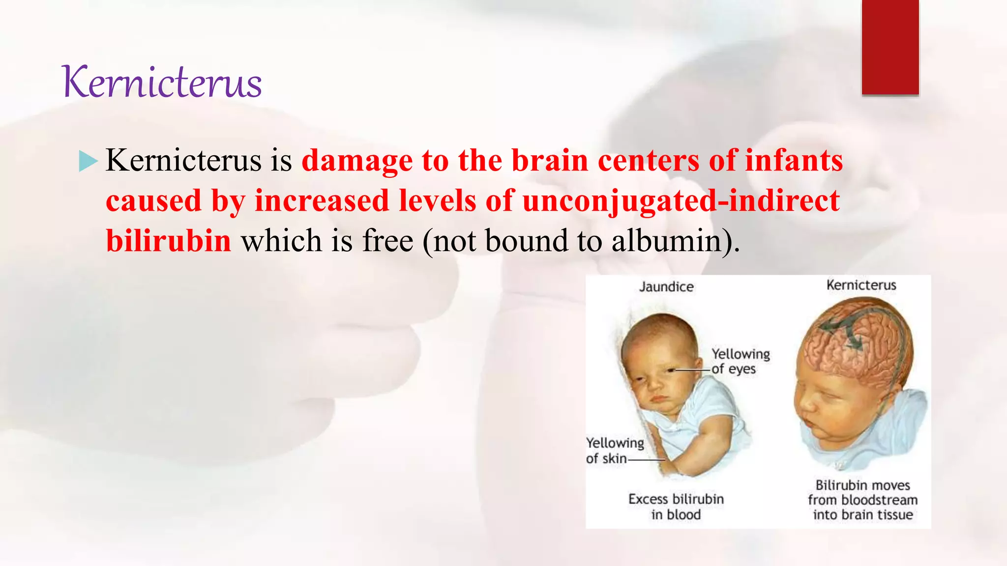 NEONATAL JAUNDICE .pptx