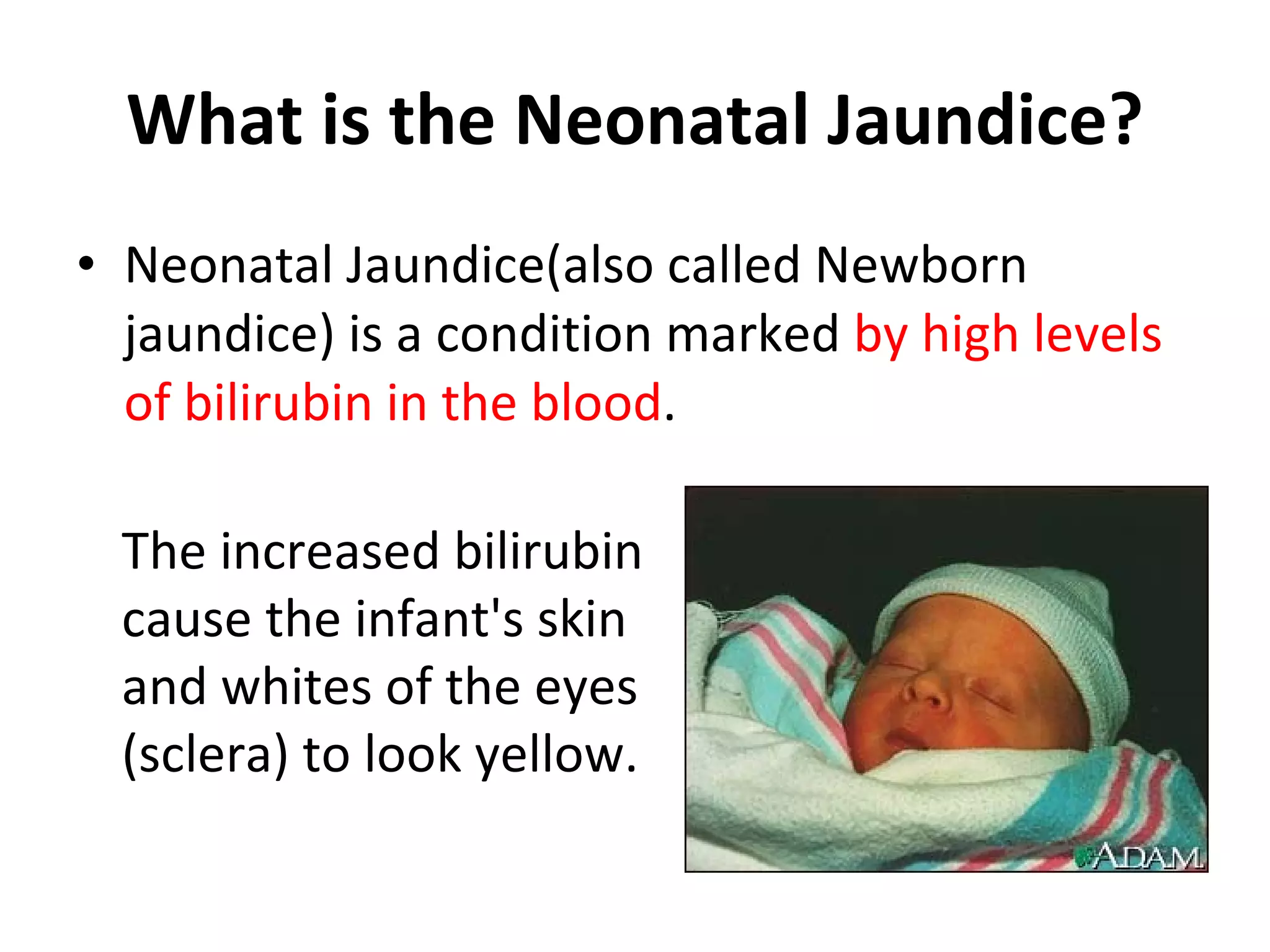 Neonatal Jaundice | PPT