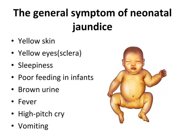 Neonatal Jaundice