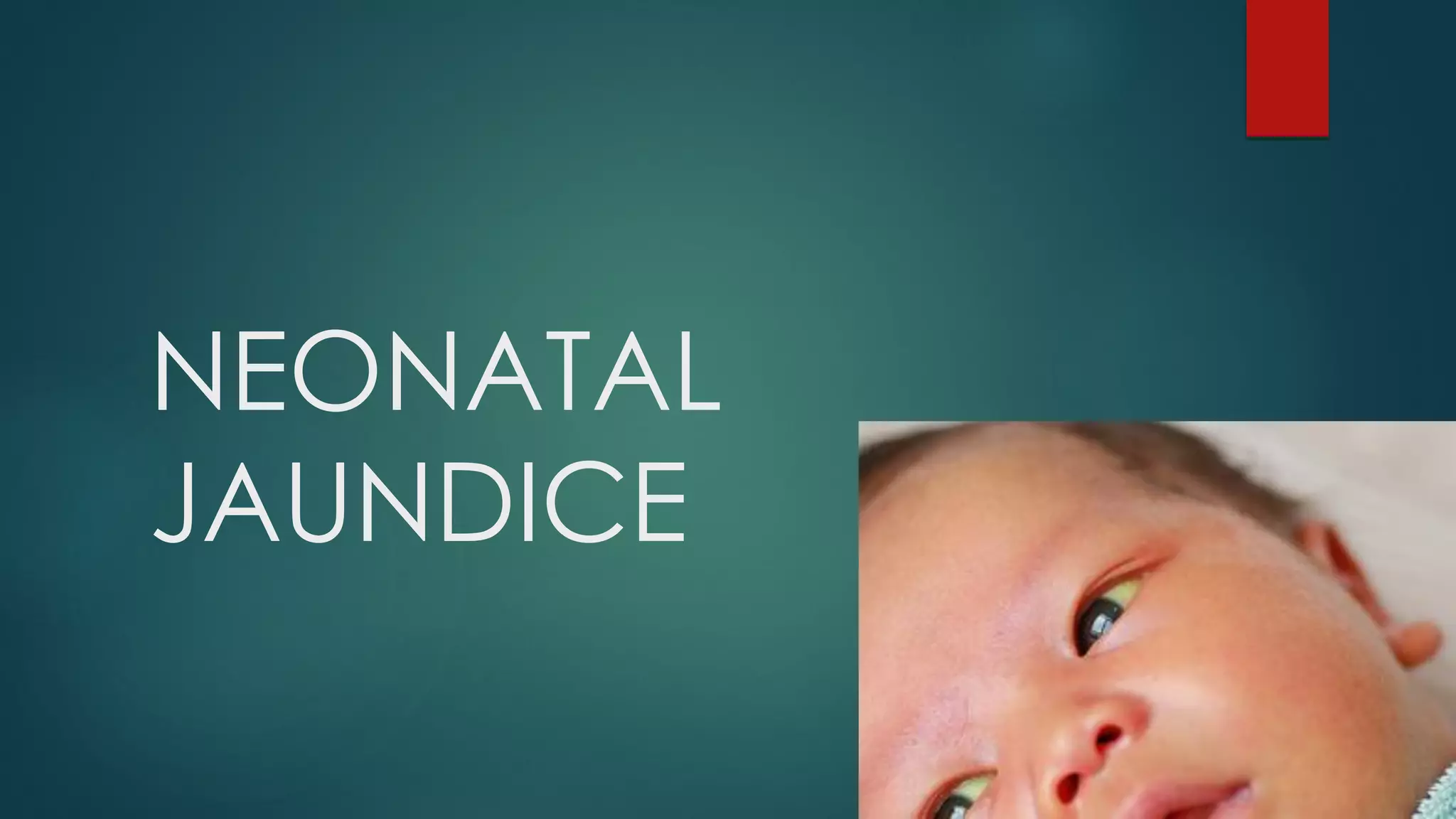 NEONATAL JAUNDICE PPT.pdf
