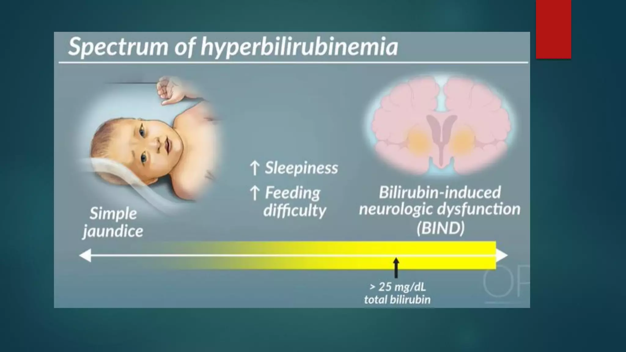 NEONATAL JAUNDICE PPT.pdf