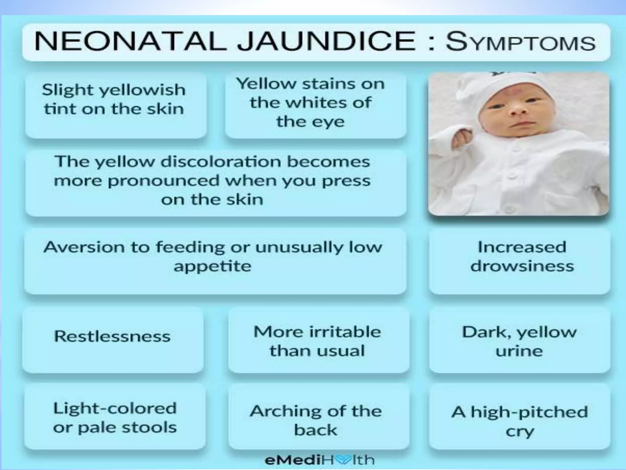 Neonatal jaundice presentation | PPTX