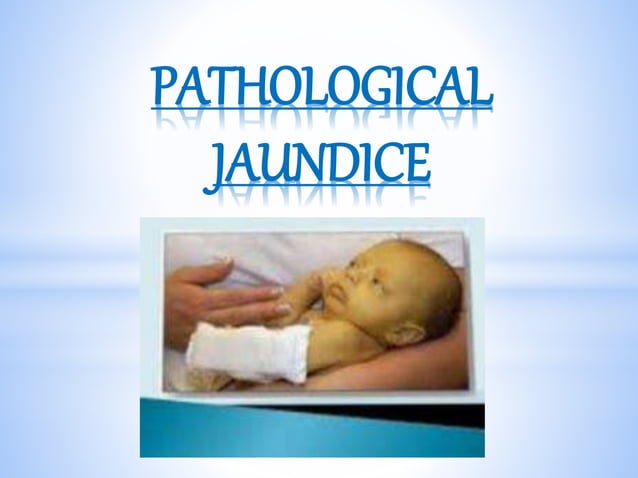 Neonatal jaundice presentation | PPTX