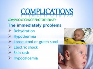 Neonatal jaundice presentation | PPTX