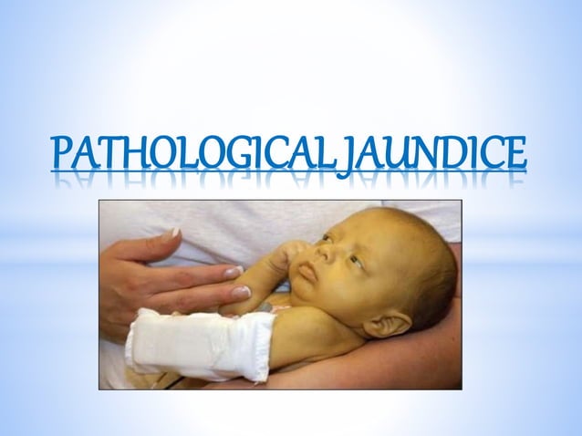 Neonatal jaundice presentation | PPTX