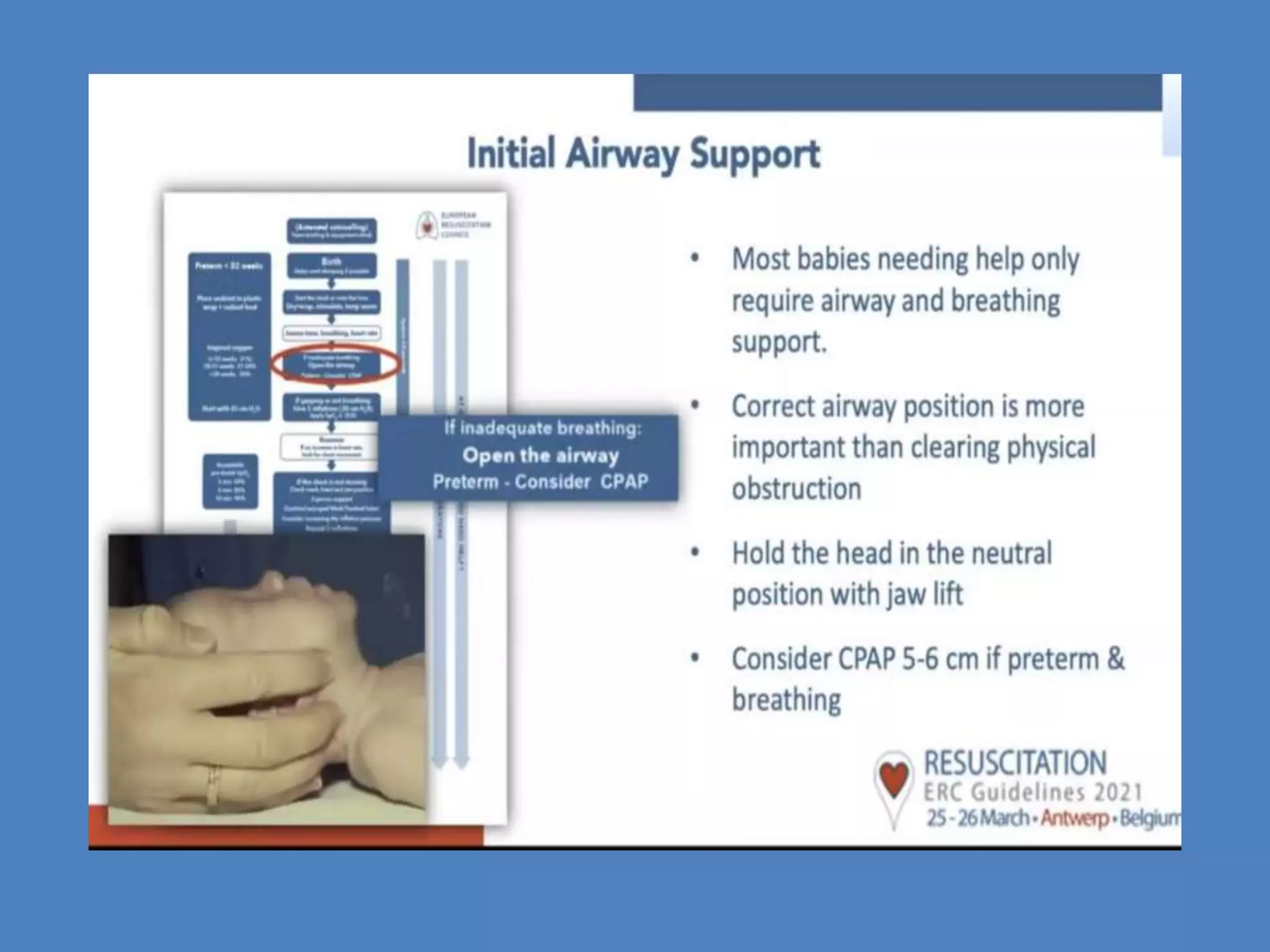 Neonatal life support | PPTX