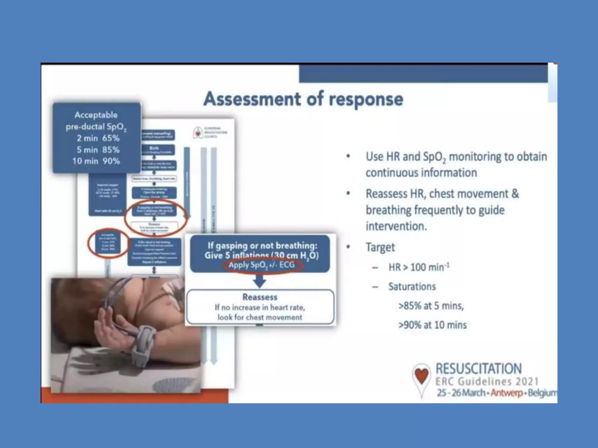 Neonatal life support | PPTX