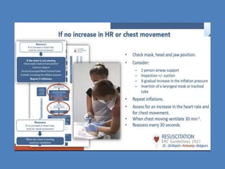 Neonatal life support | PPTX