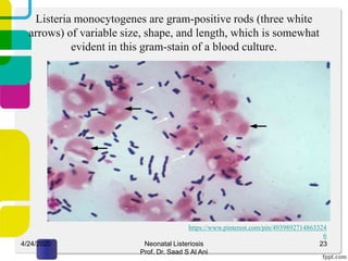 Neonatal listeriosis | PPT