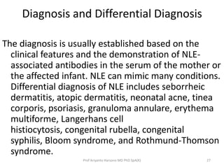 Neonatal lupus erythematosus | PPTX