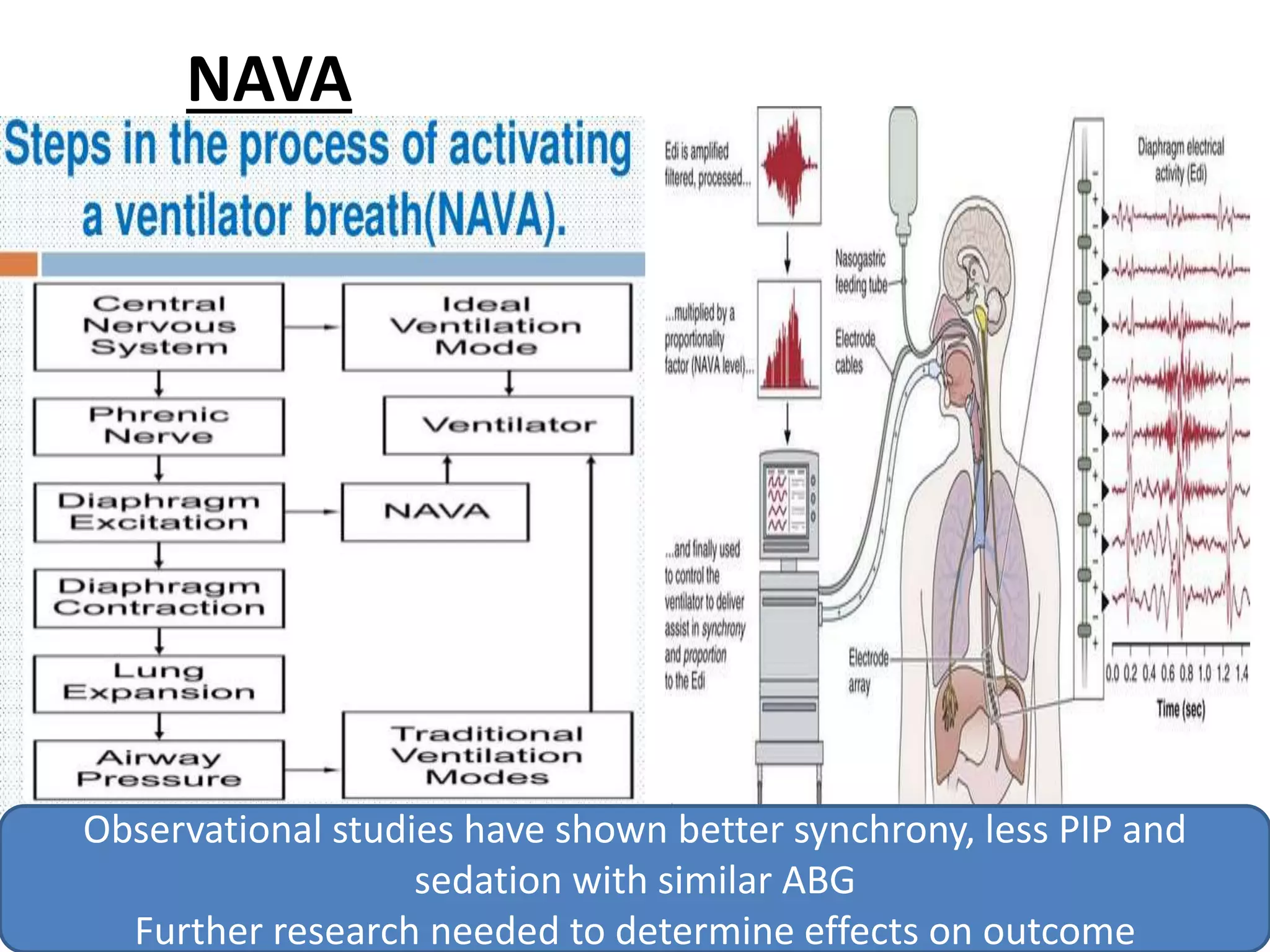 Neonatal mechanical ventilation | PPTX