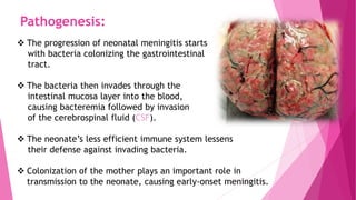 Neonatal Meningtis | PPTX