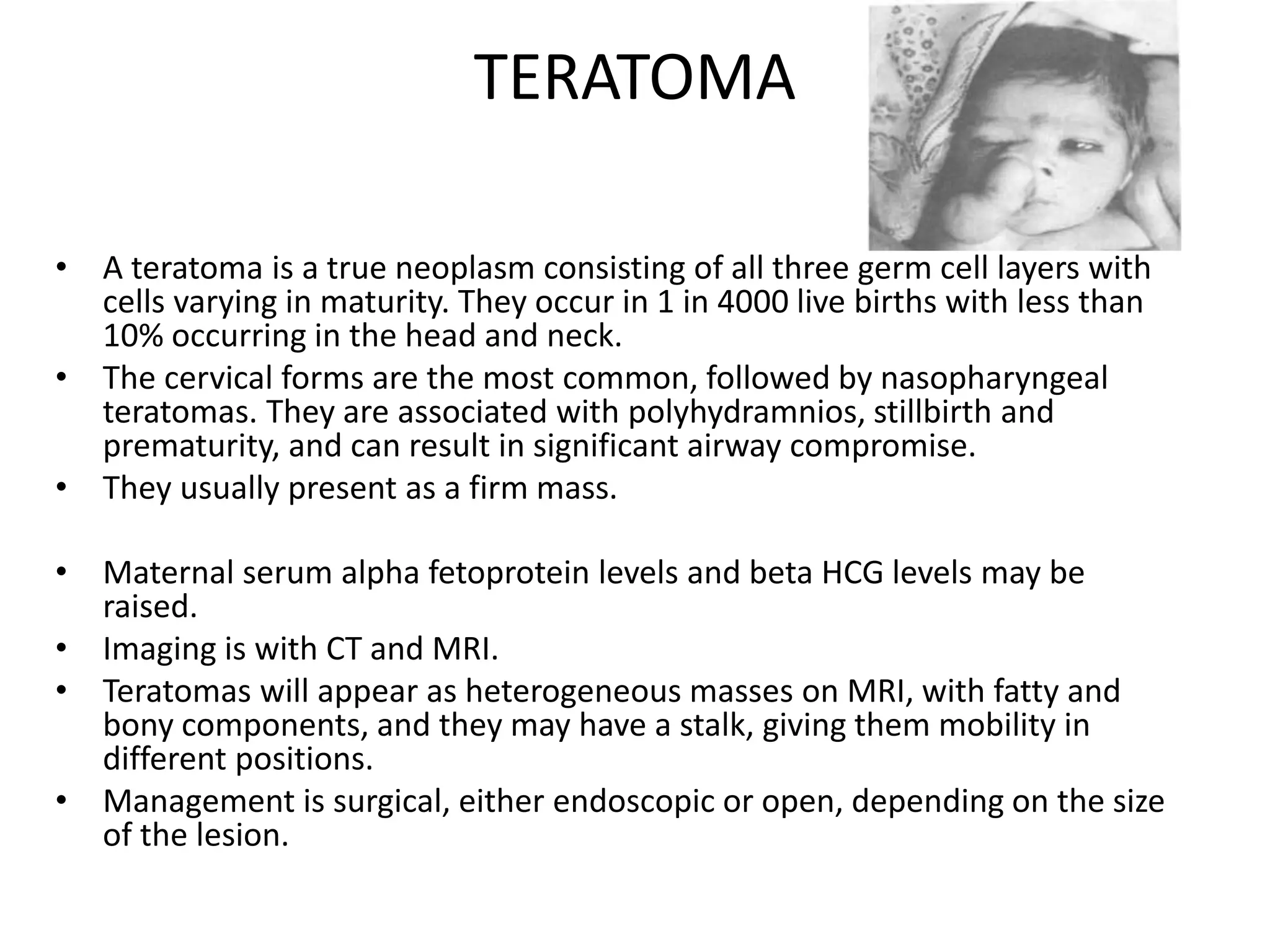 Neonatal nasal obstruction final | PPTX