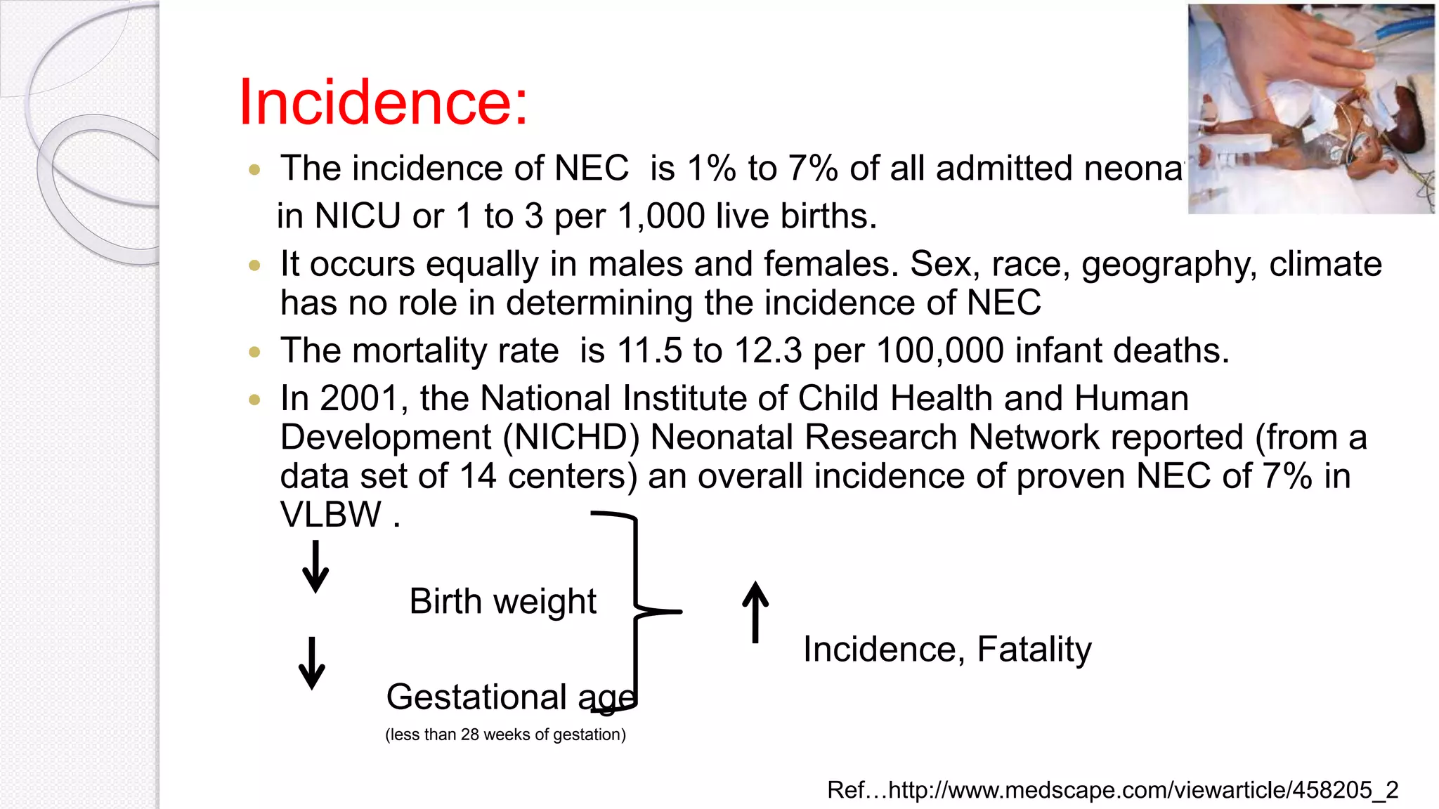 Neonatal Necrotizing Enterocolitis | PPTX